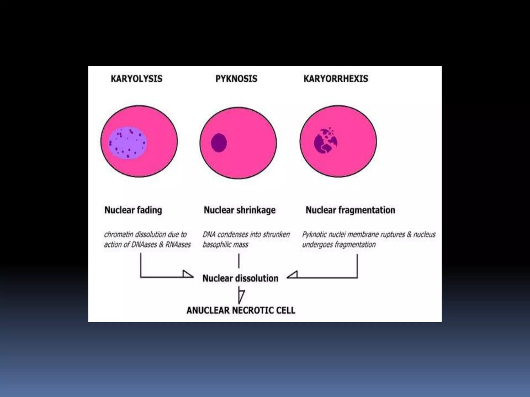 02-Necrosis and apoptosis-1.ppt