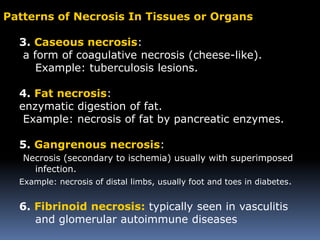 02-Necrosis and apoptosis-1.ppt