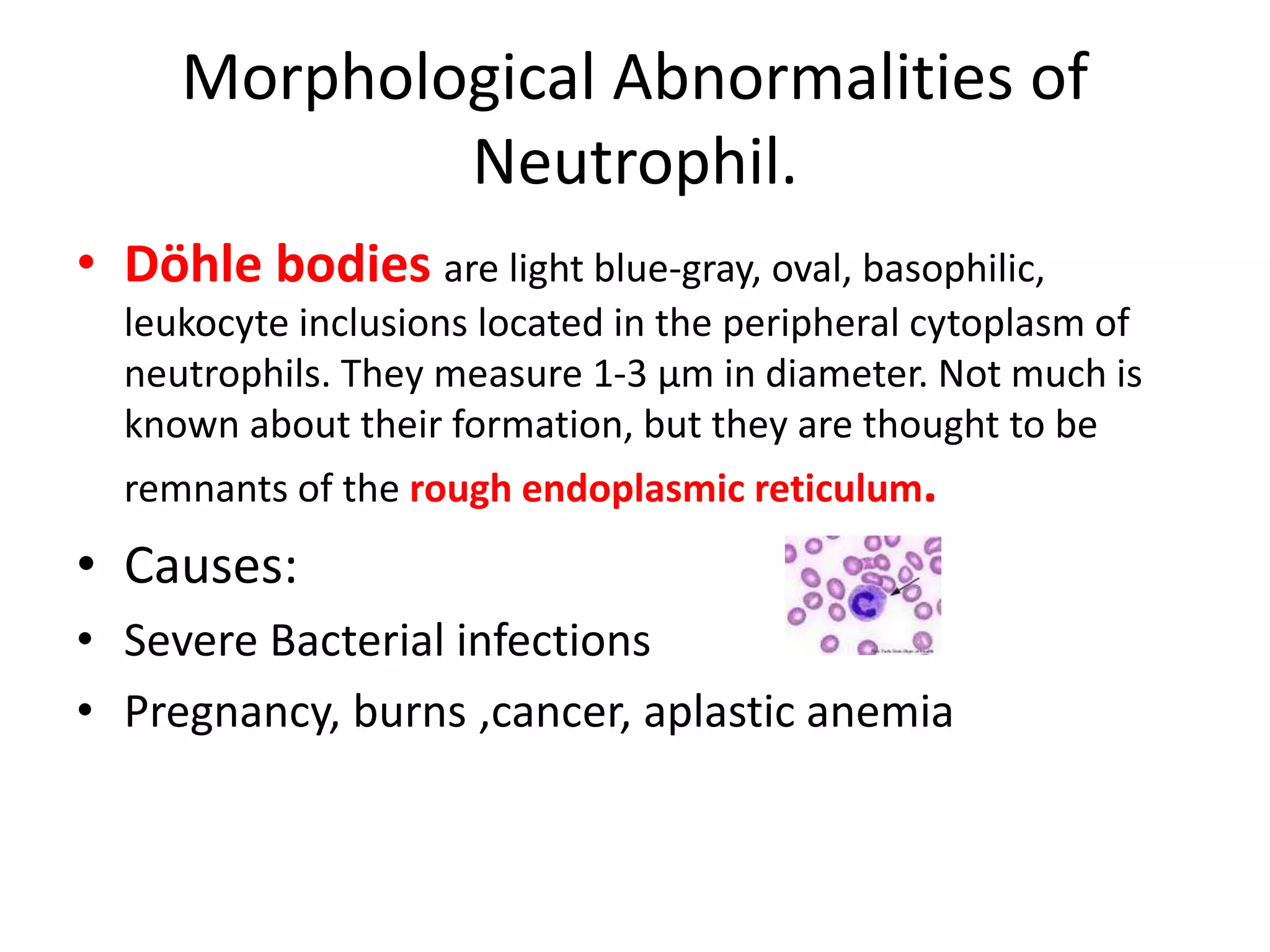 02 neutropenia | PPTX
