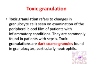 02 neutropenia | PPTX