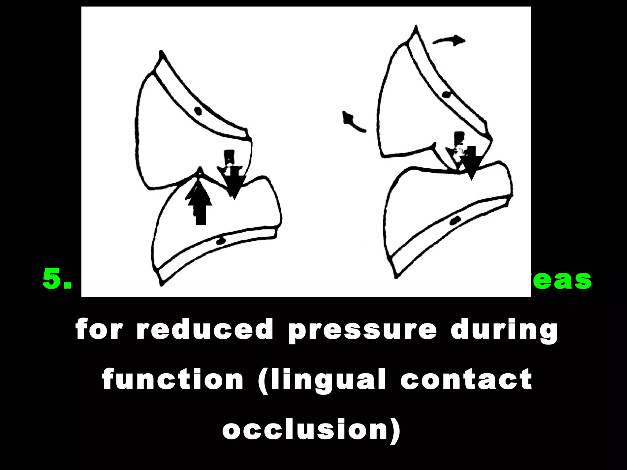 02 occlusion in prosthodontics. balanced occlusion | PPT