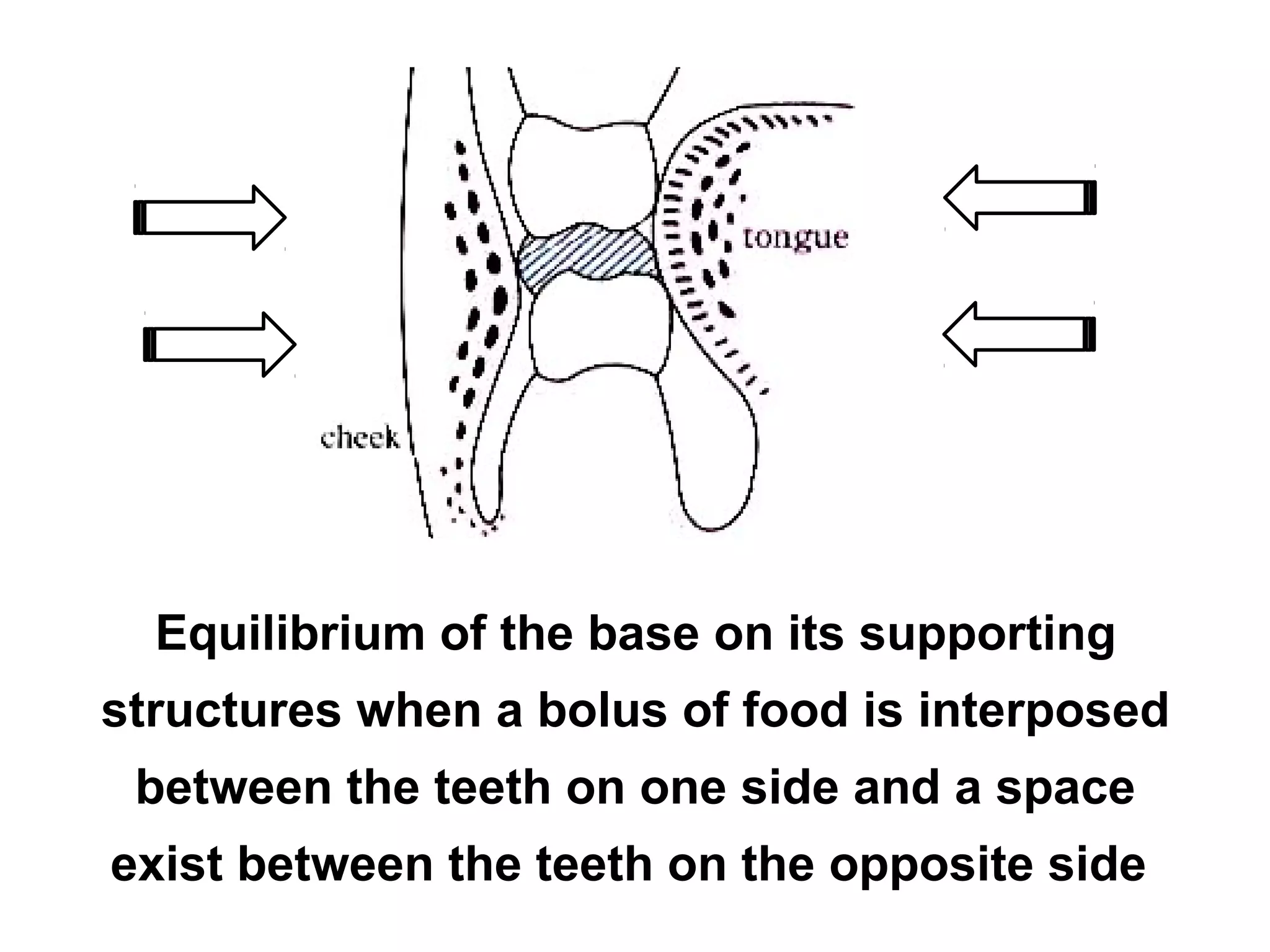 02 occlusion in prosthodontics. balanced occlusion | PPT
