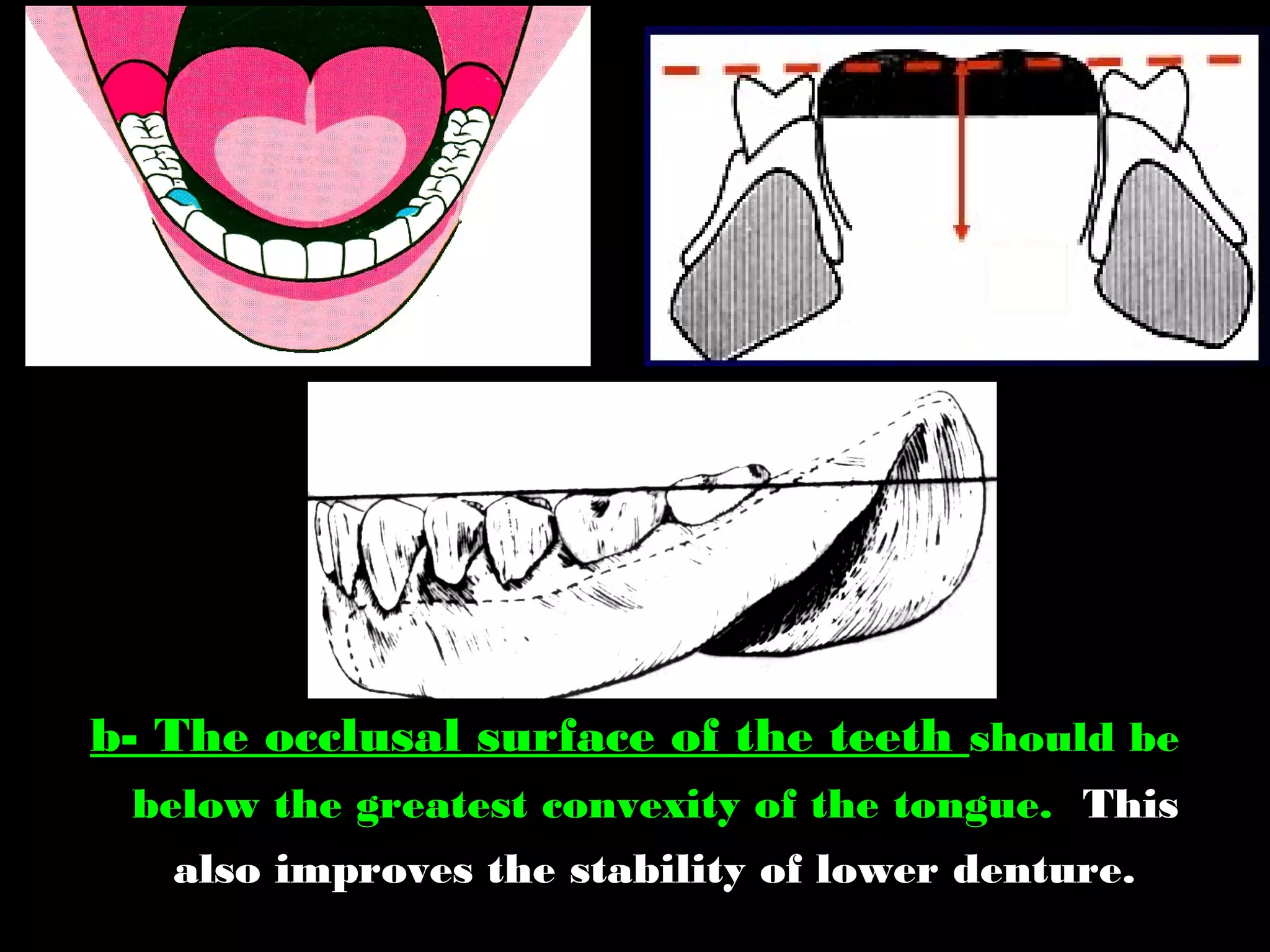 02 occlusion in prosthodontics. balanced occlusion | PPT