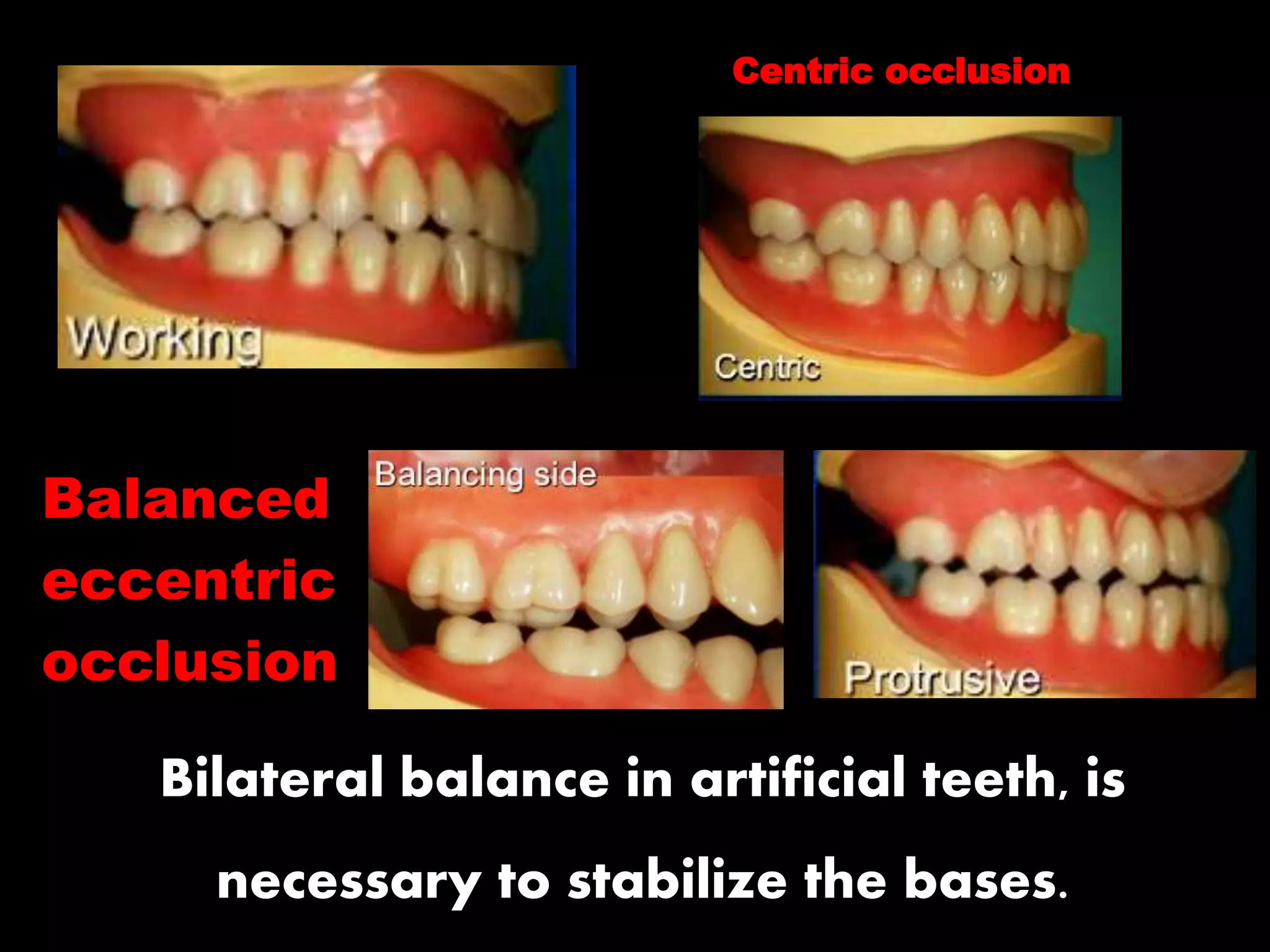 02- Occlusion in prosthodontics. Balanced occlusion | PPT