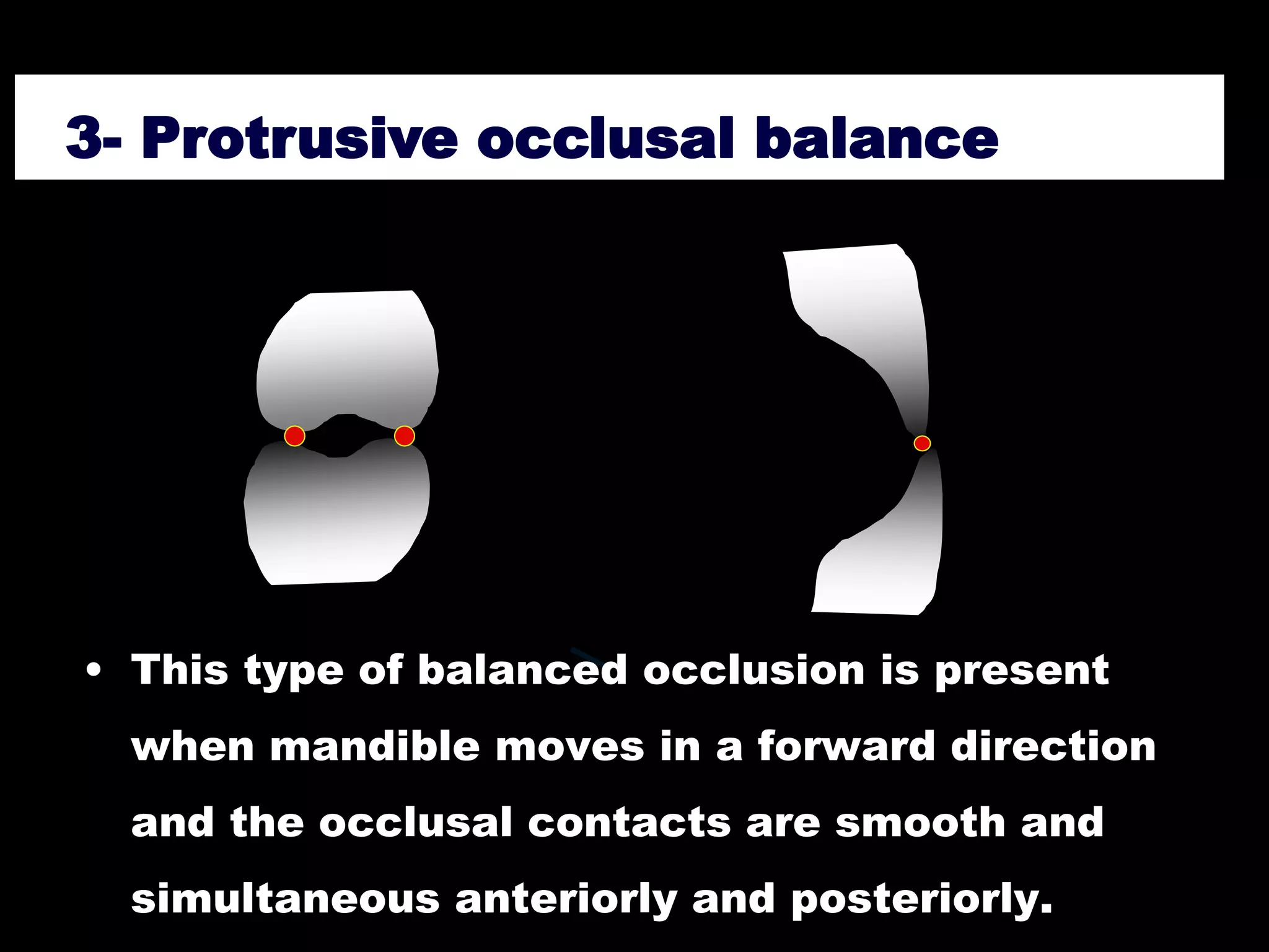 02- Occlusion in prosthodontics. Balanced occlusion | PPT