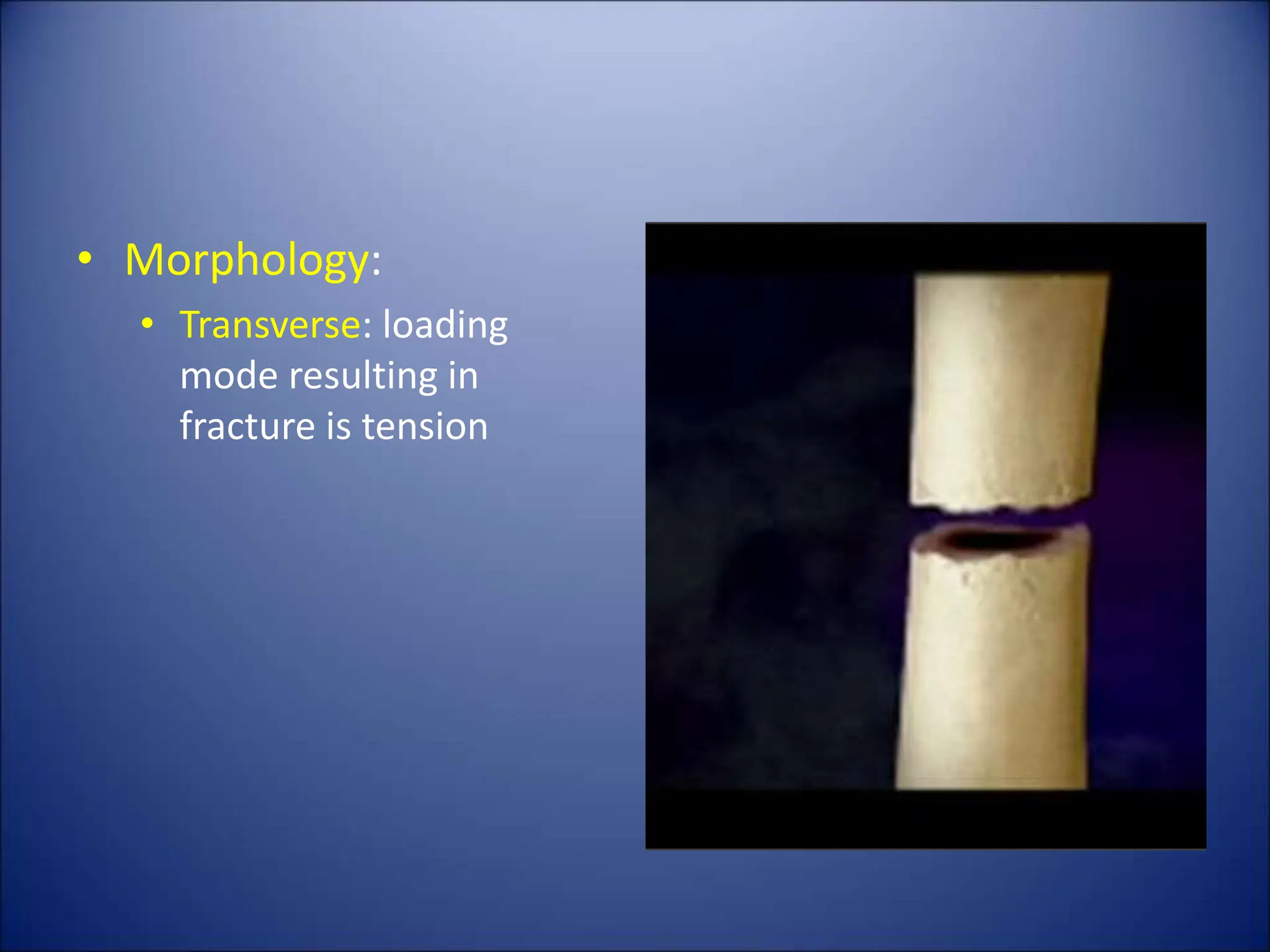 Principles of Fractures. Principle of Fractures | PPT