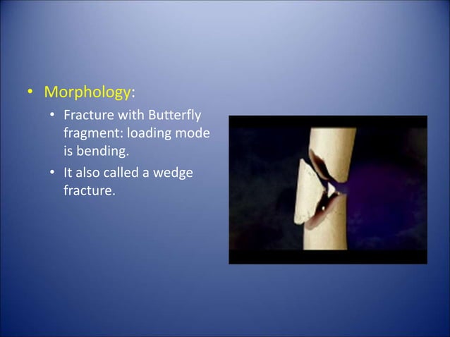Principles of Fractures. Principle of Fractures | PPT