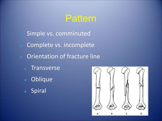 Principles of Fractures. Principle of Fractures | PPT