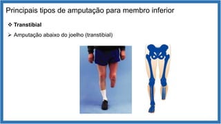 02 - Técnicas cirúrgicas de amputação.pdf
