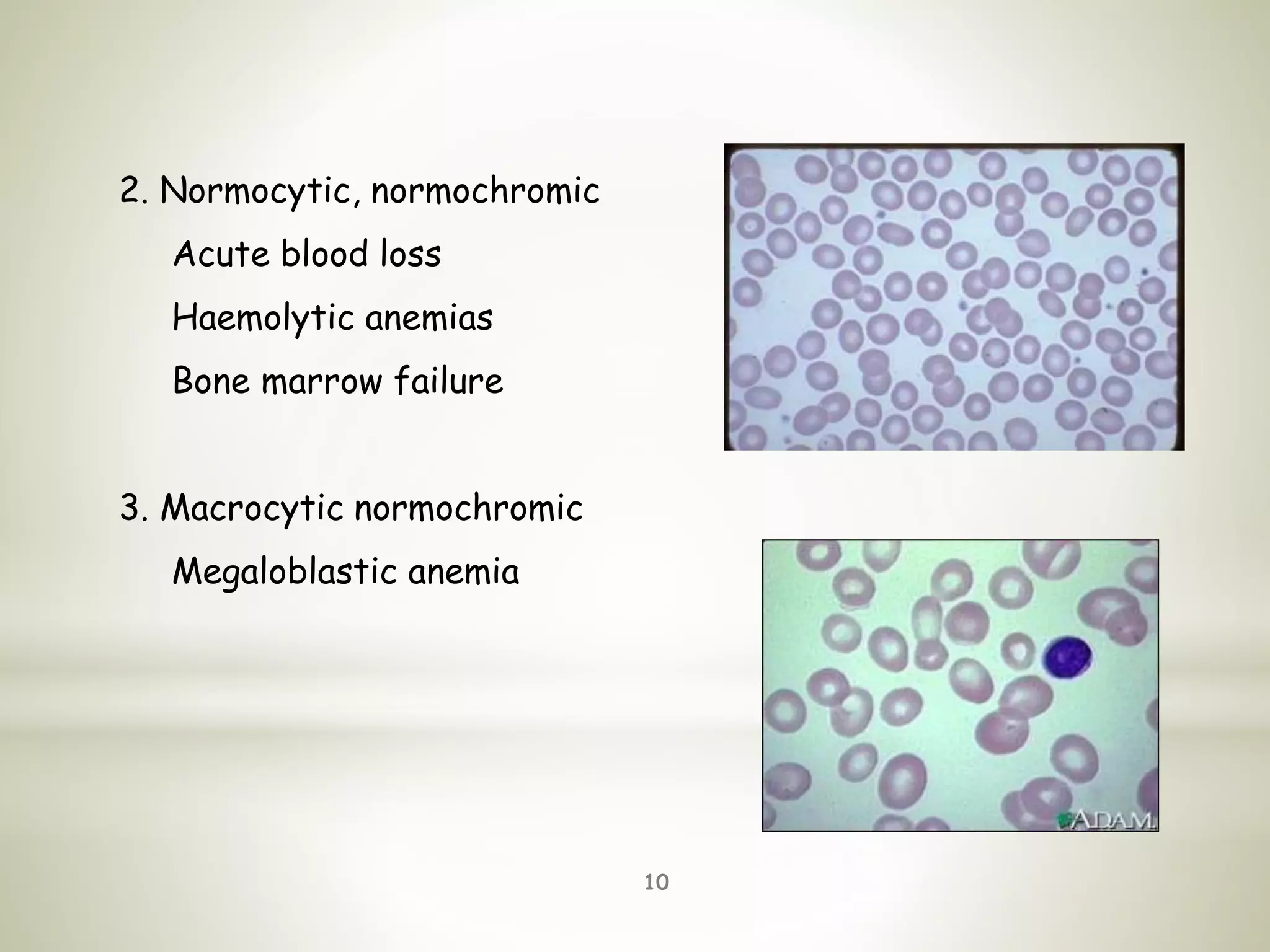 Anemia Causes, Types, Symptoms, Diet, and Treatment | PPTX