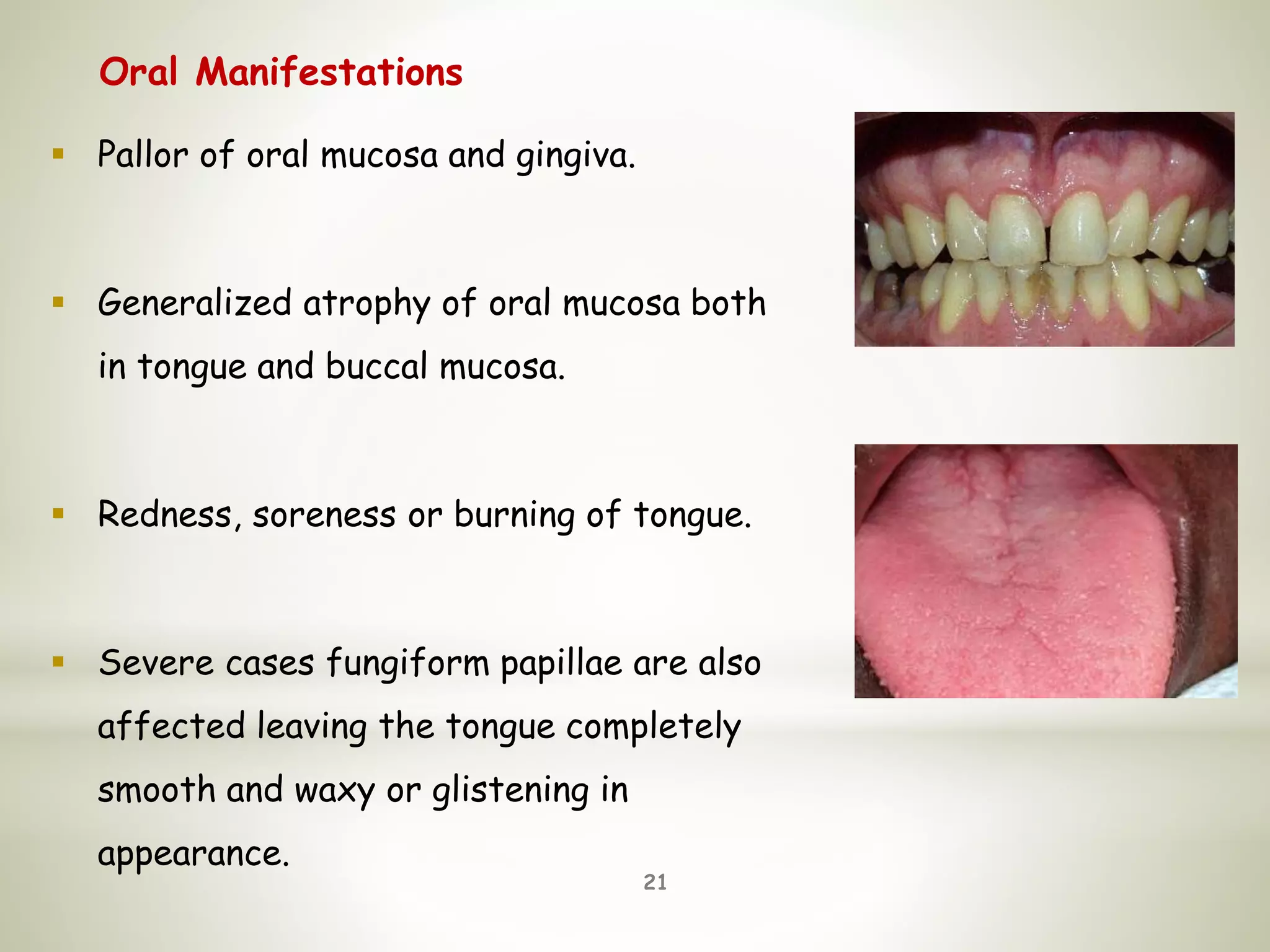 Anemia Causes, Types, Symptoms, Diet, and Treatment | PPTX