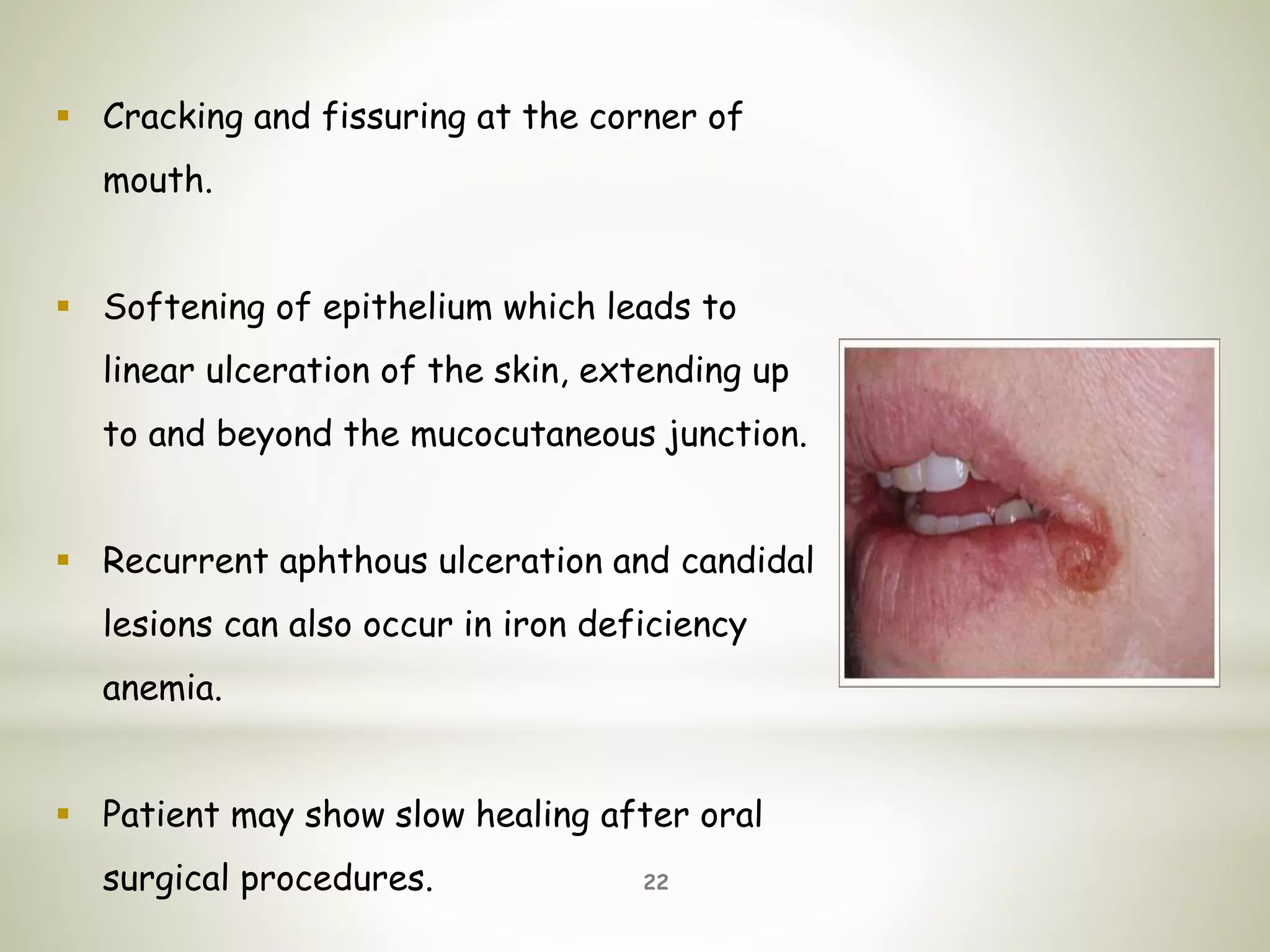 Anemia Causes, Types, Symptoms, Diet, and Treatment | PPTX