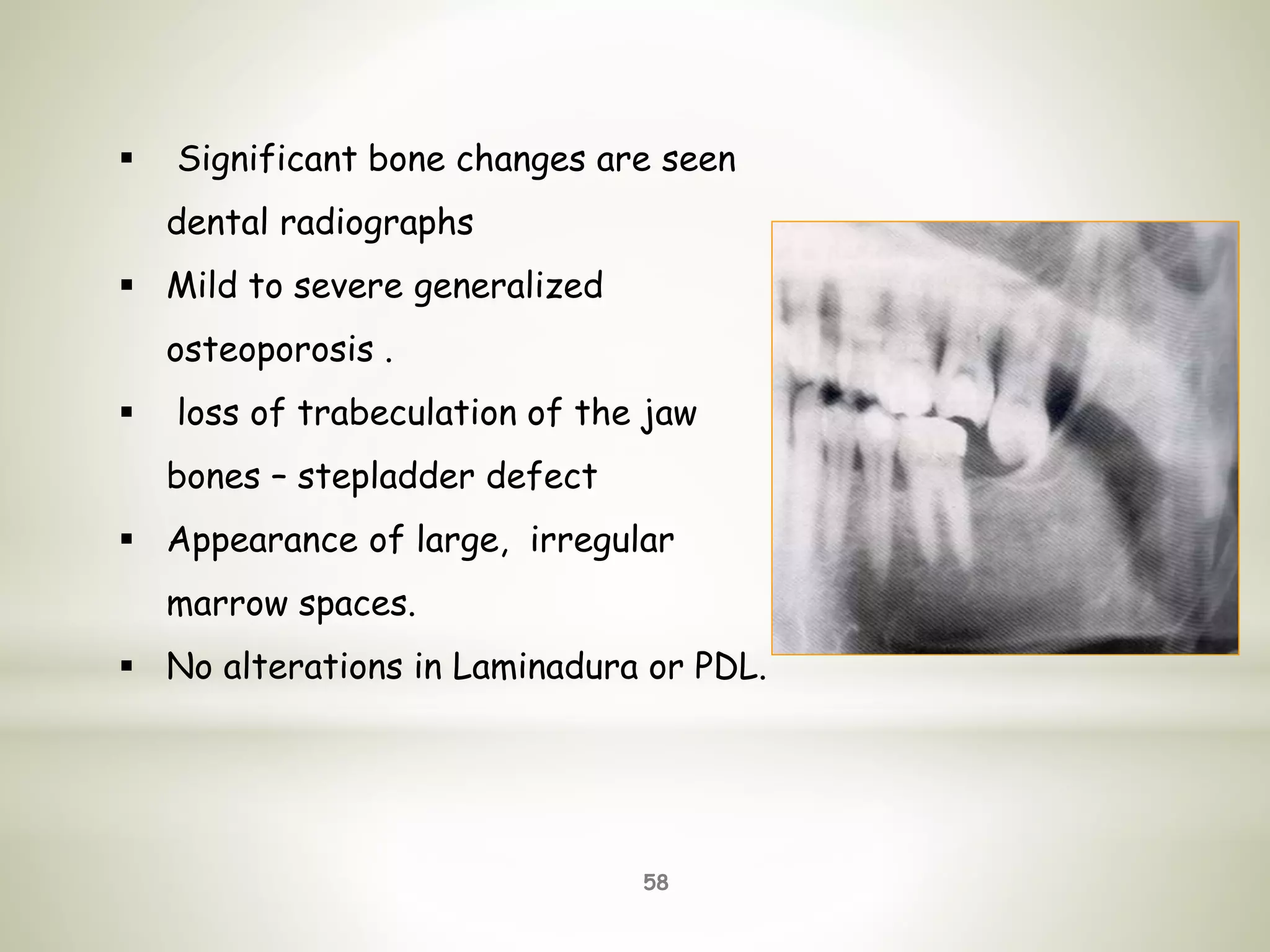 Anemia Causes, Types, Symptoms, Diet, and Treatment | PPTX