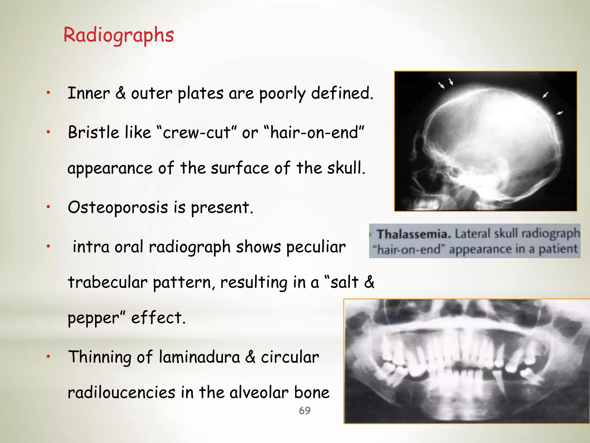 Anemia Causes, Types, Symptoms, Diet, and Treatment | PPTX