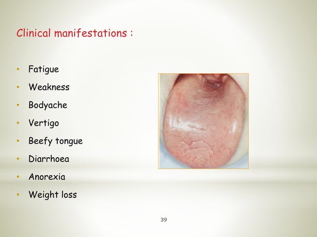 Anemia Causes, Types, Symptoms, Diet, and Treatment | PPTX