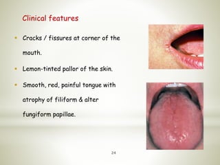 Anemia Lips
