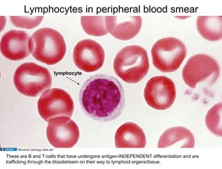 Lymphocyte Histology