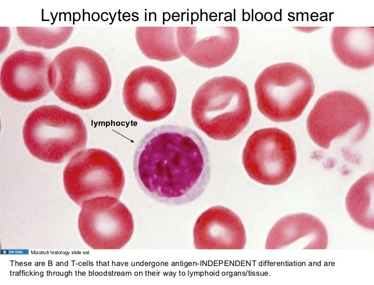 Lymphocyte Histology