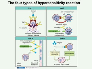 02.17.09(a): Types I - IV Immunopathology | PDF