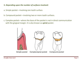 023.periodontal pocket | PDF