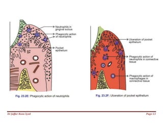 periodontal pocket | DOCX