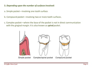 periodontal pocket | DOCX