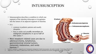 Subserosal Cecal Lipoma : A rare Cause of Ileo-colic Intussusception in ...