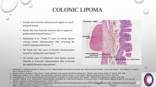 Subserosal Cecal Lipoma : A rare Cause of Ileo-colic Intussusception in ...