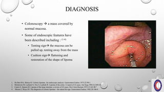 Subserosal Cecal Lipoma : A rare Cause of Ileo-colic Intussusception in ...