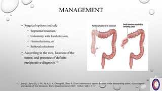 Subserosal Cecal Lipoma : A rare Cause of Ileo-colic Intussusception in ...