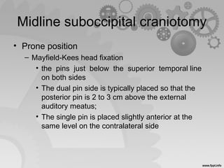 026 positioning for cranial surgery | PPT