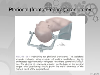 026 positioning for cranial surgery | PPT