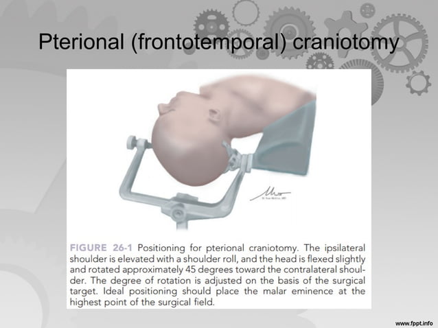 026 positioning for cranial surgery | PPT | Death, Injury, or Military ...