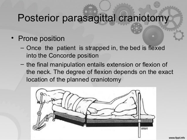 026 positioning for cranial surgery