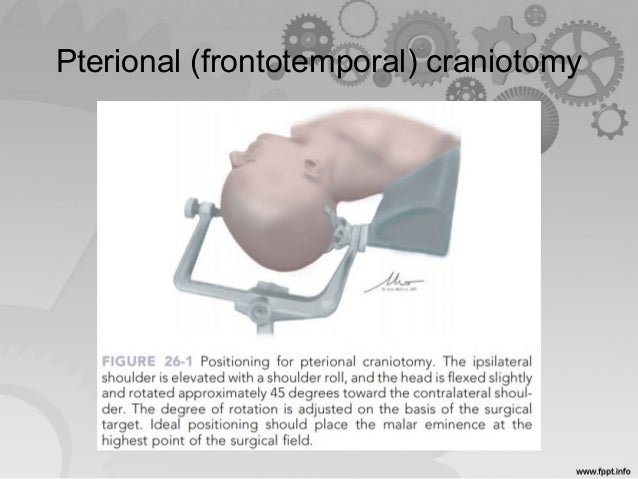 026 positioning for cranial surgery