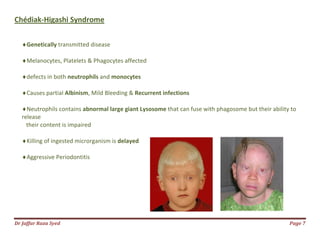 Necrotizing Ulcerative Periodontitis Nup