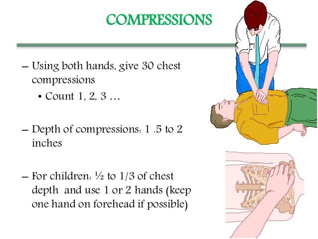 Cardiopulmonary resuscitation (CPR) - an emergency procedure