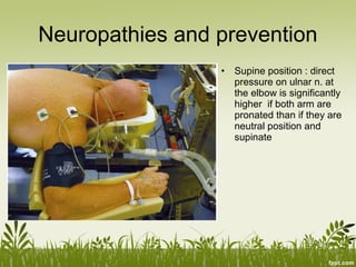 027 Patient posioning for spine surgery | PPT