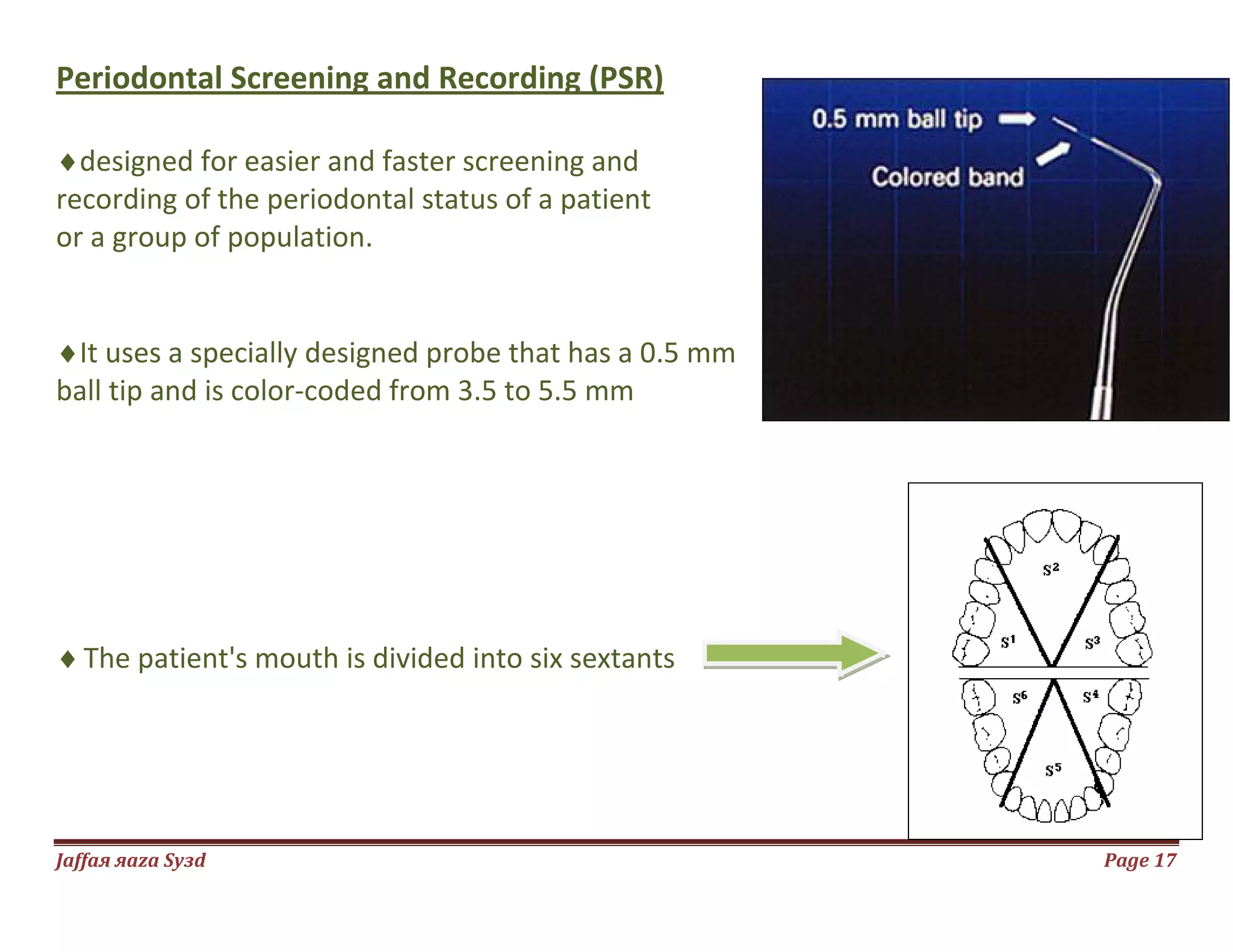 029.periodontal diagnosis and prognosis | PDF