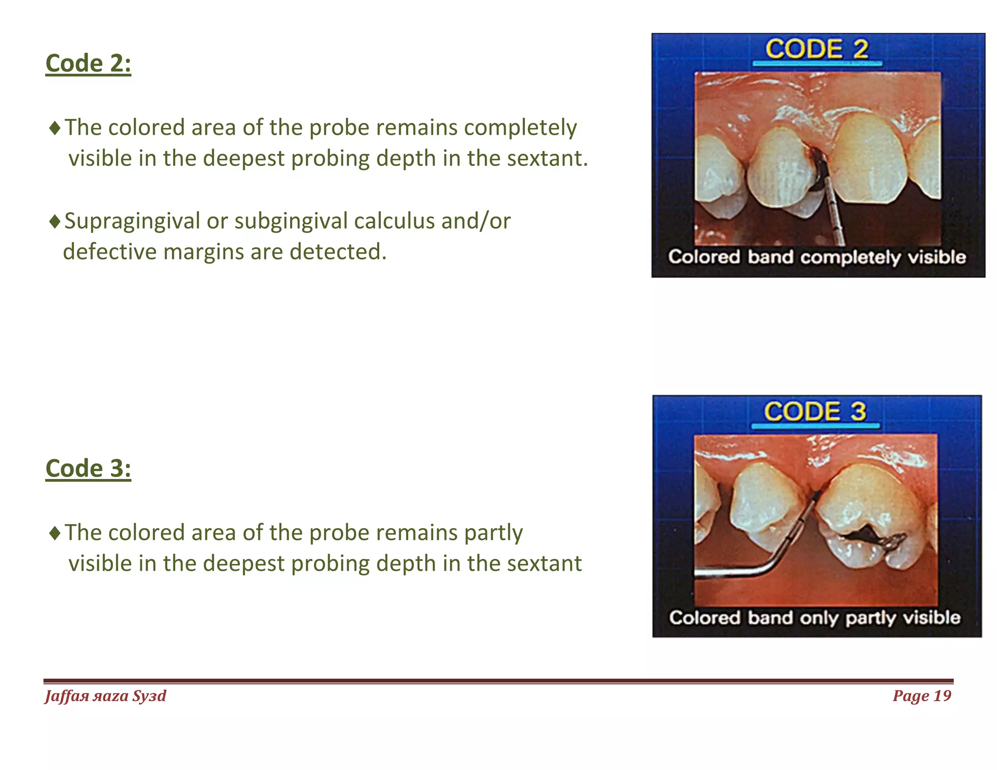 029.periodontal diagnosis and prognosis | PDF