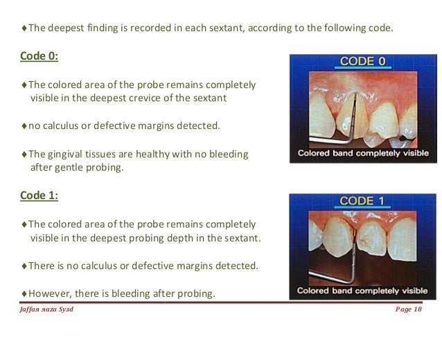 029.periodontal diagnosis and prognosis