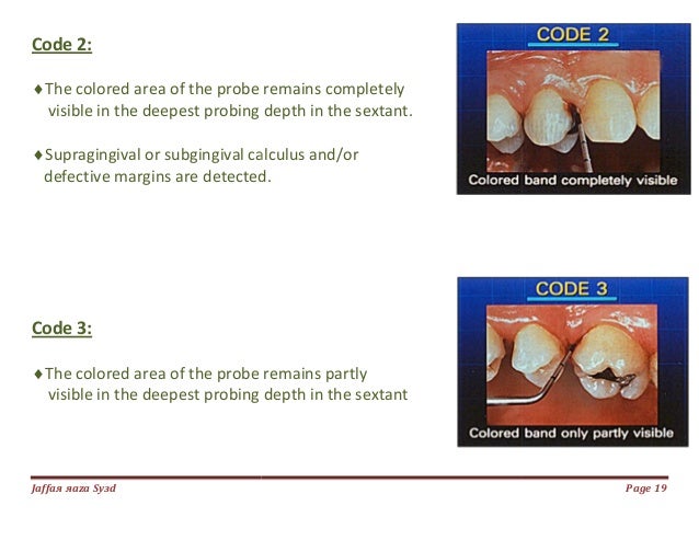 029.periodontal diagnosis and prognosis