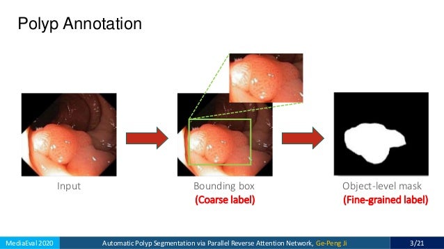 Automatic Polyp Segmentation Via Parallel Reverse Attention Network