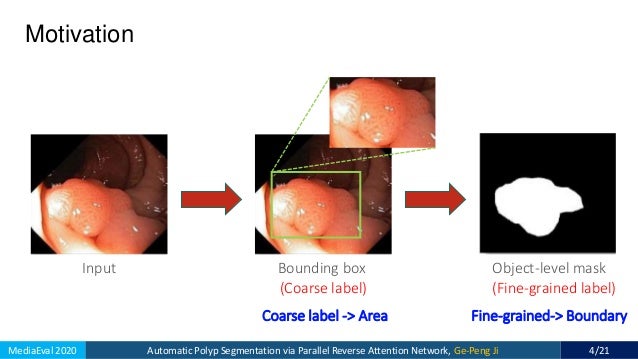 Automatic Polyp Segmentation Via Parallel Reverse Attention Network