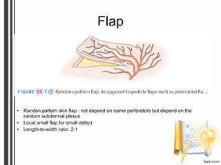 029 Incision and closure | PPT