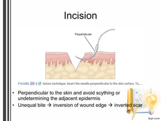 029 Incision and closure | PPT