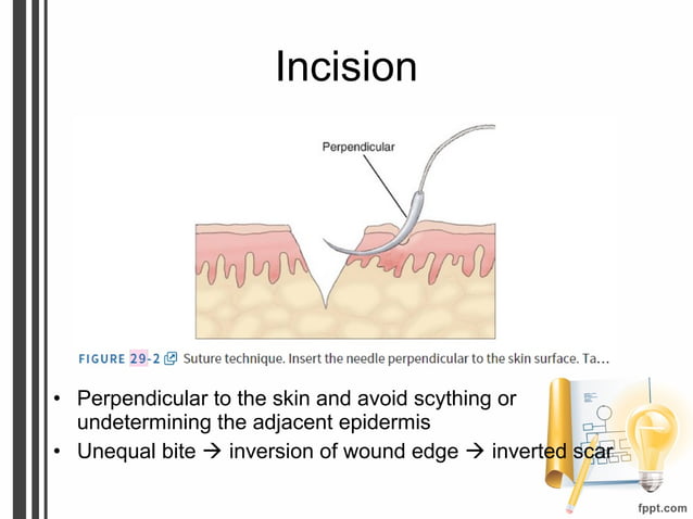 029 Incision and closure | PPT