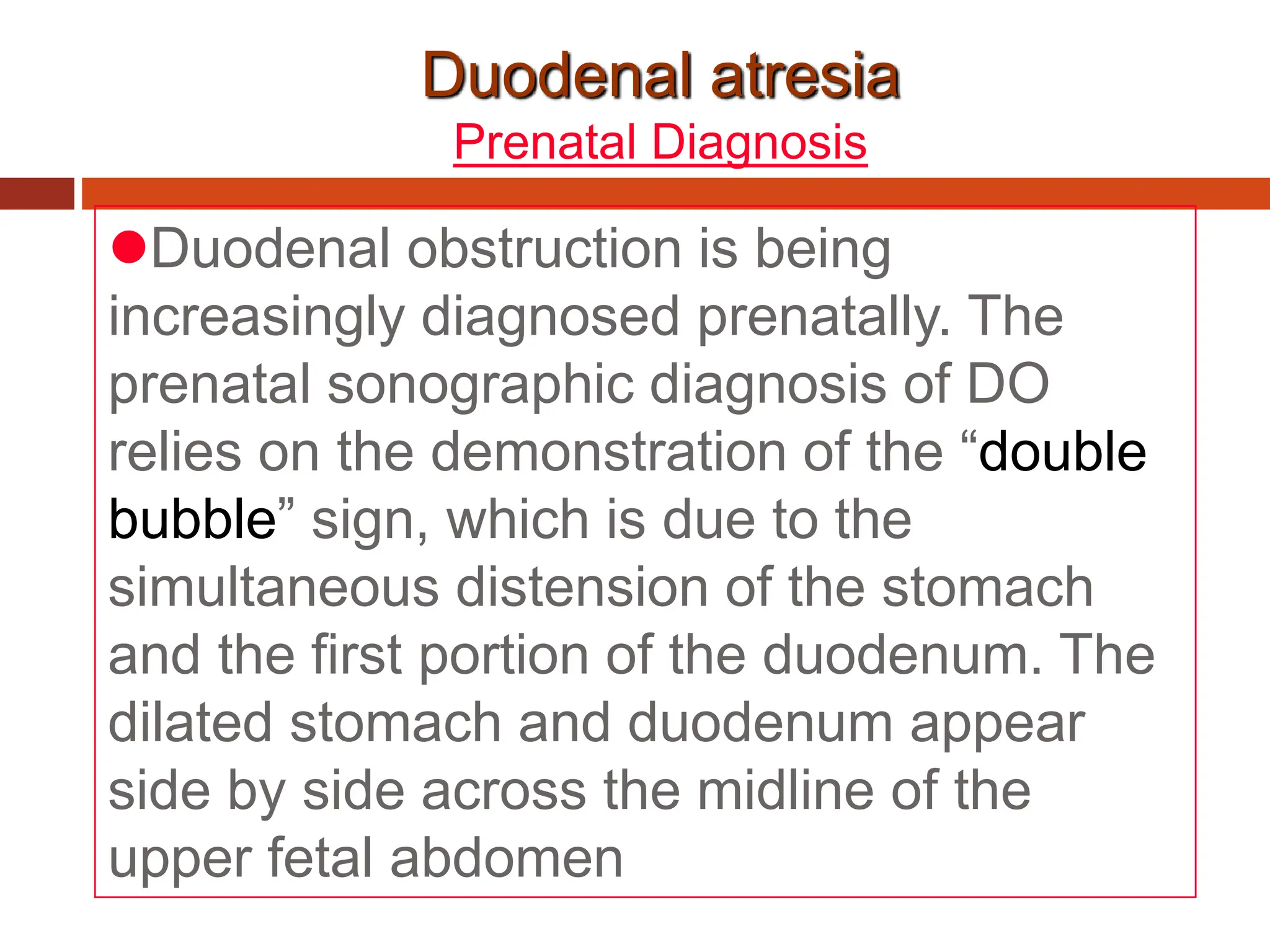 (02) Atresia Duodenum and management.ppt