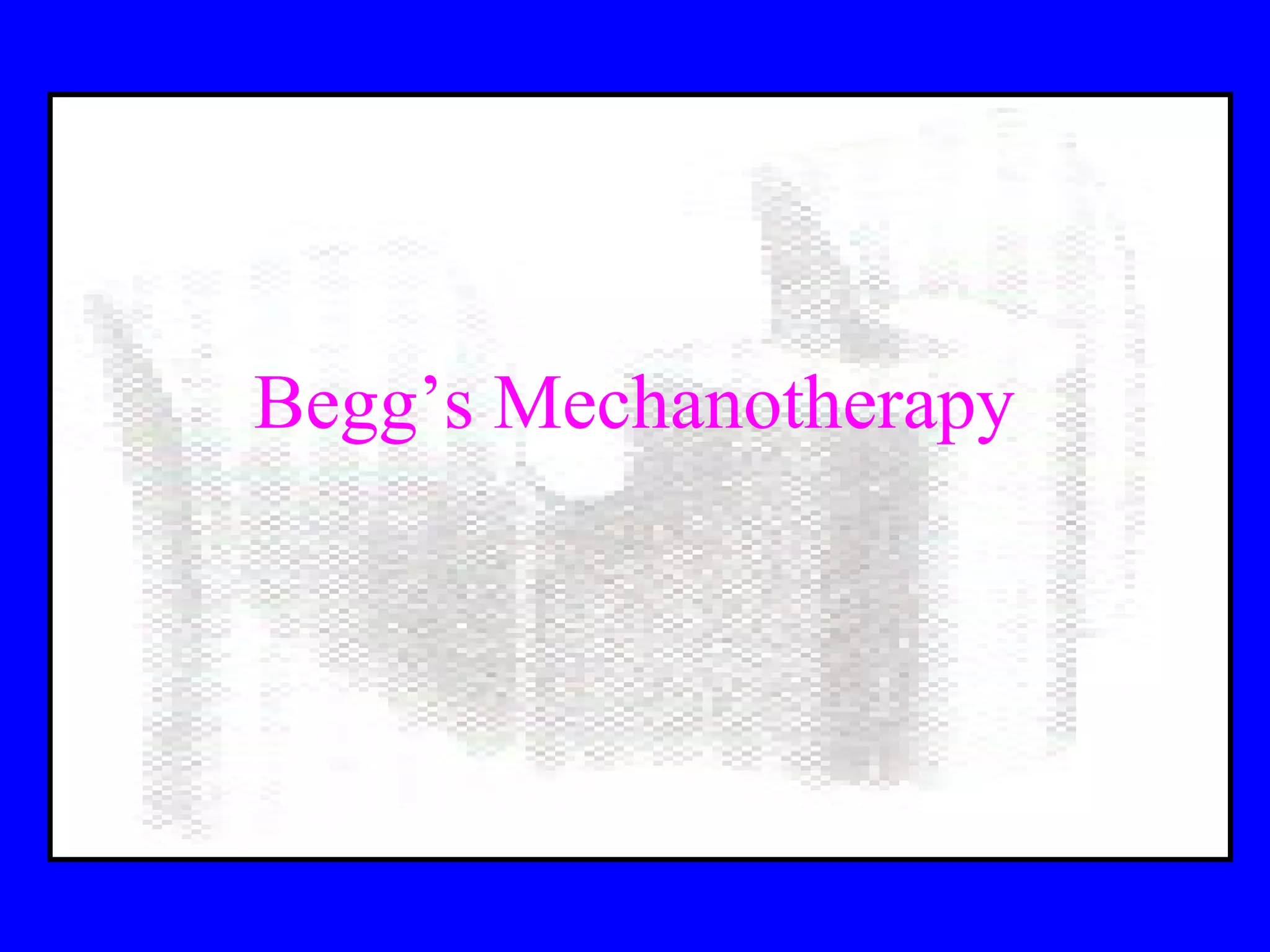beggs technique bends | PPT