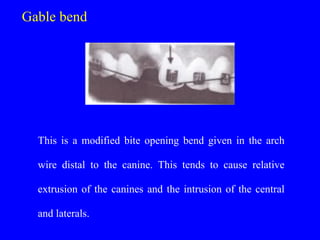 beggs technique bends | PPT